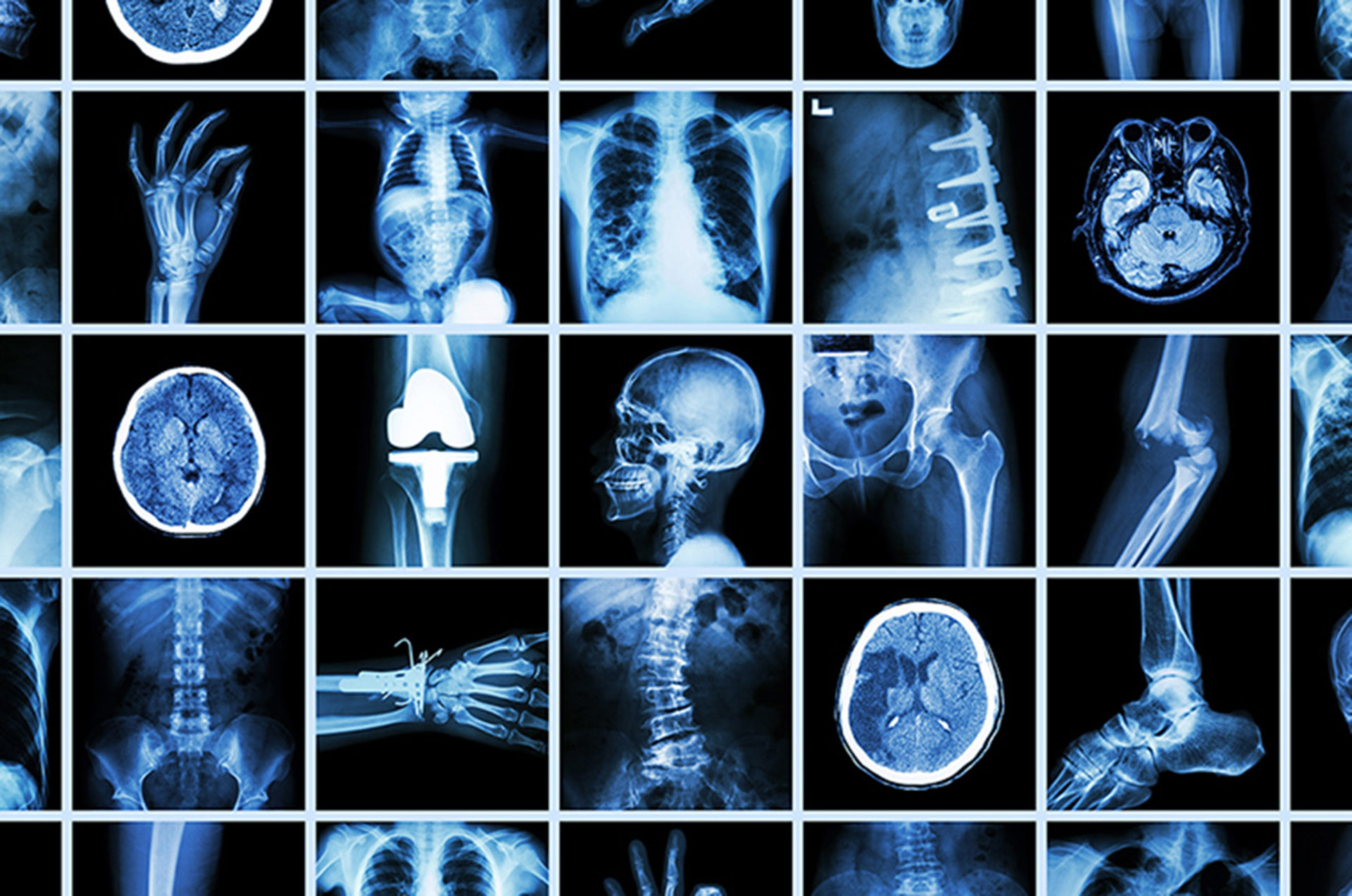 Imaging (Radiology) Services | Penn Highlands Healthcare